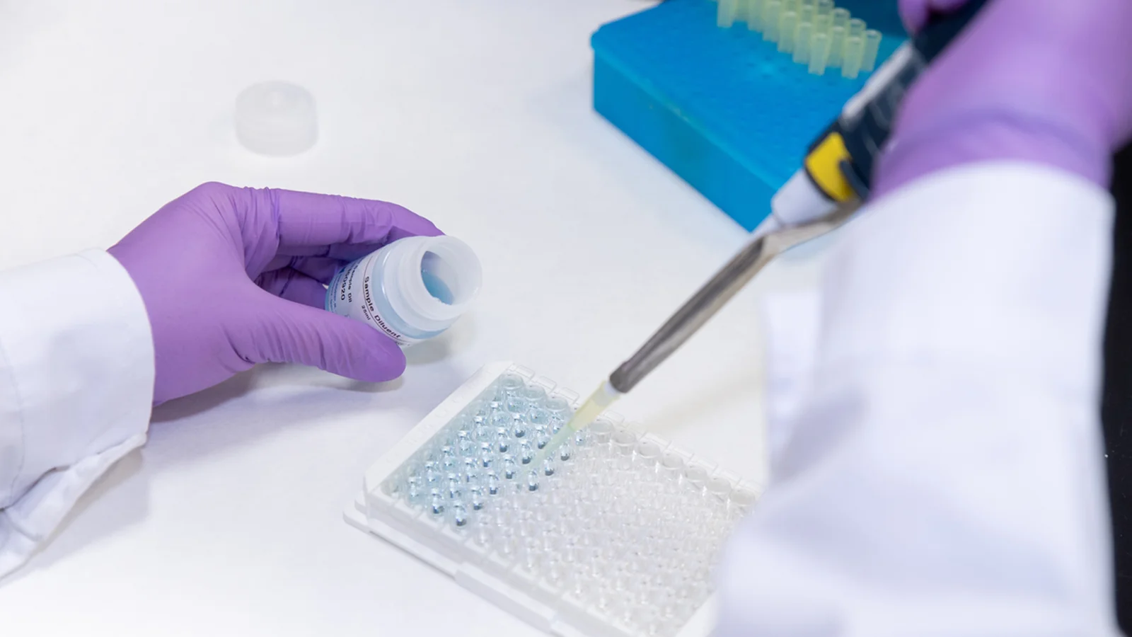 SARS-CoV-2 Multiantigen Kit for Flow Cytometry | Immunostep - IgG/IgA ...